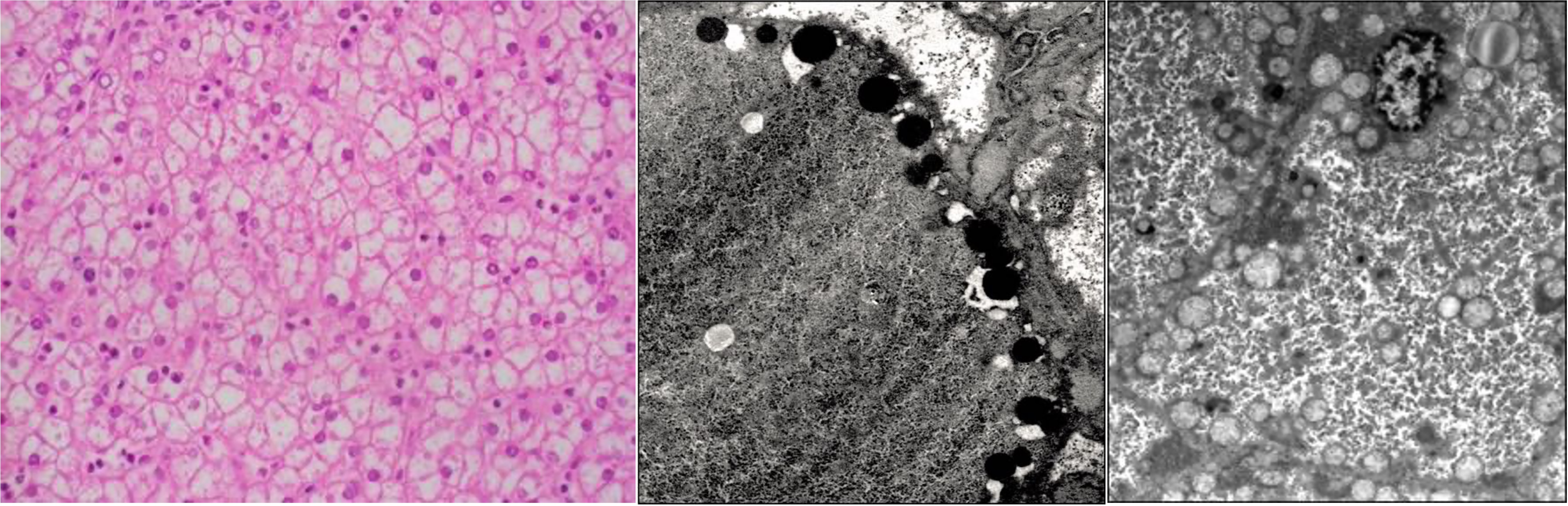 Exploring Pediatric Pathology – Helping Pathologists Help Kids