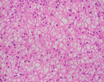 Case 2: 8 month-old Male with Abdominal Distention – Exploring ...