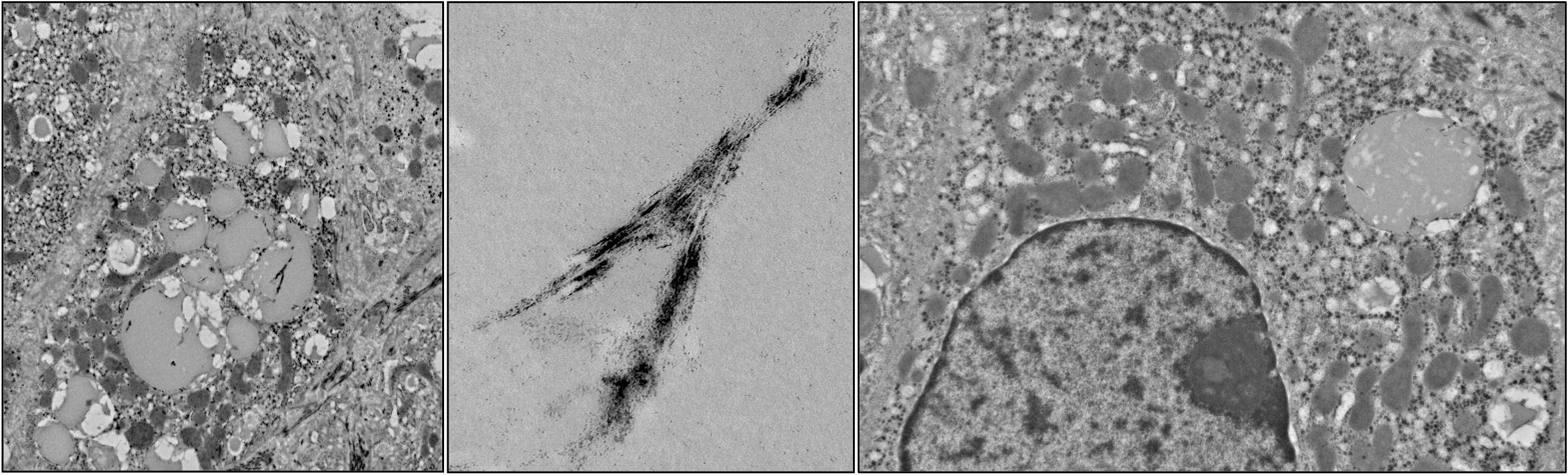 Exploring Pediatric Pathology – Helping Pathologists Help Kids