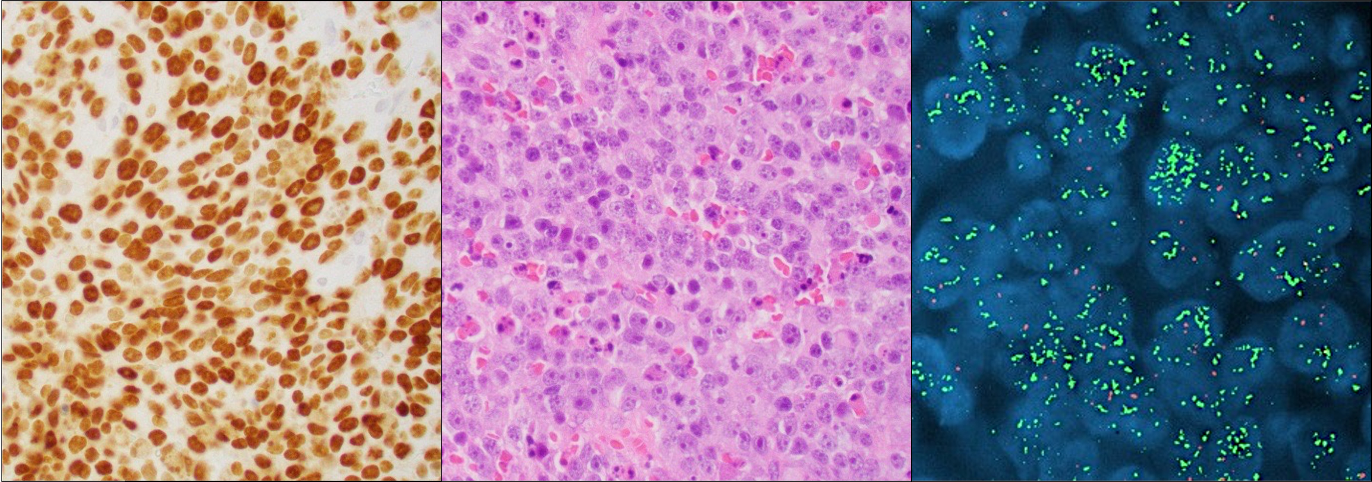 Exploring Pediatric Pathology – Helping Pathologists Help Kids