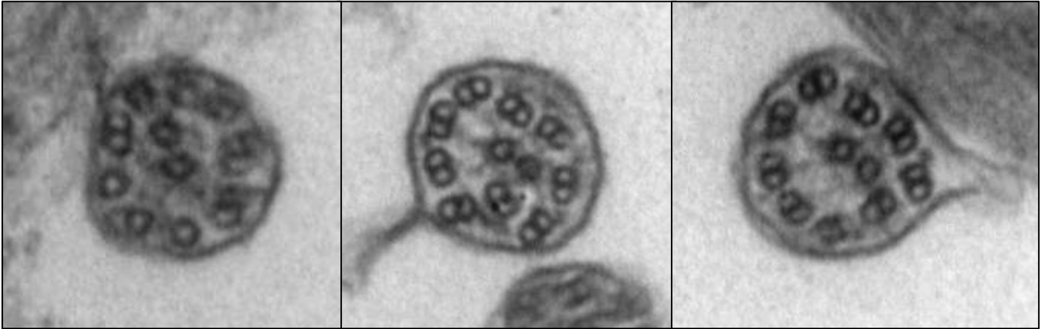 Exploring Pediatric Pathology – Helping Pathologists Help Kids