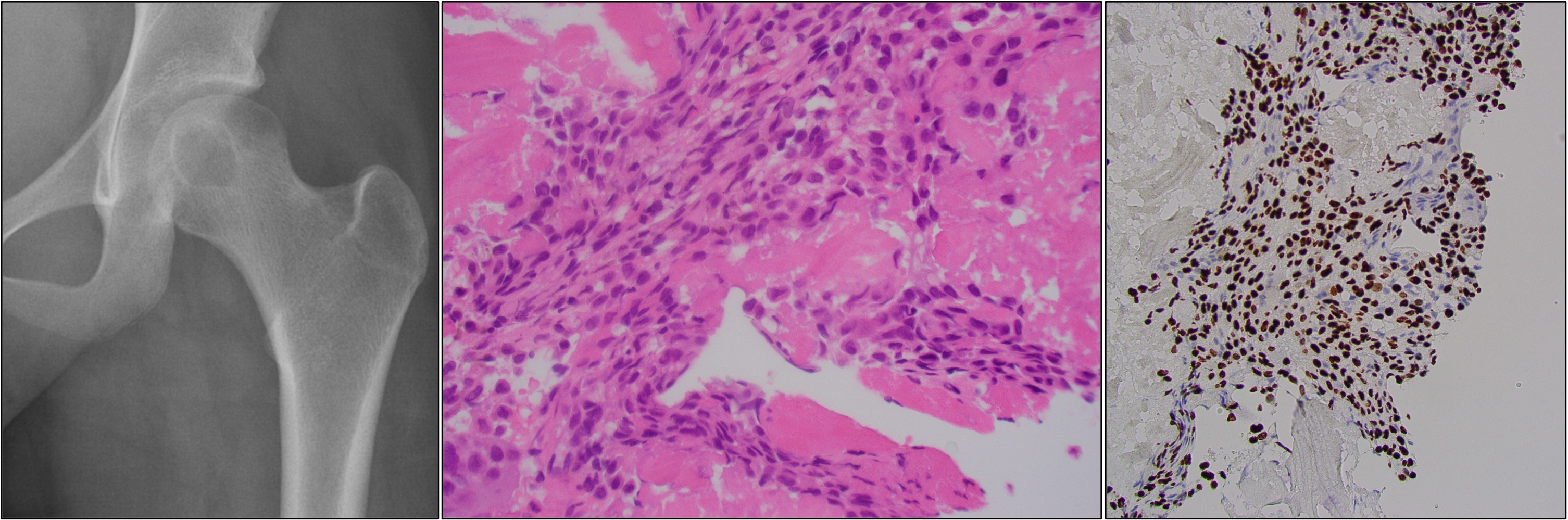 Exploring Pediatric Pathology – Helping Pathologists Help Kids