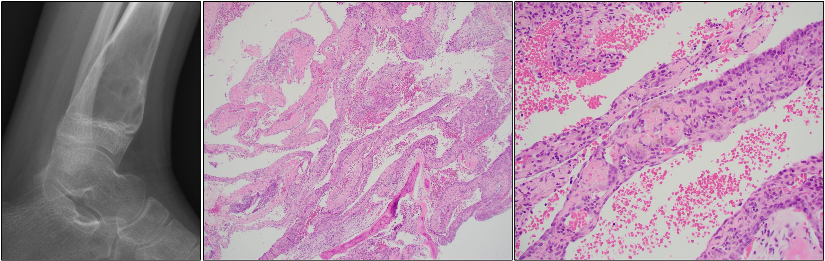 Exploring Pediatric Pathology – Helping Pathologists Help Kids