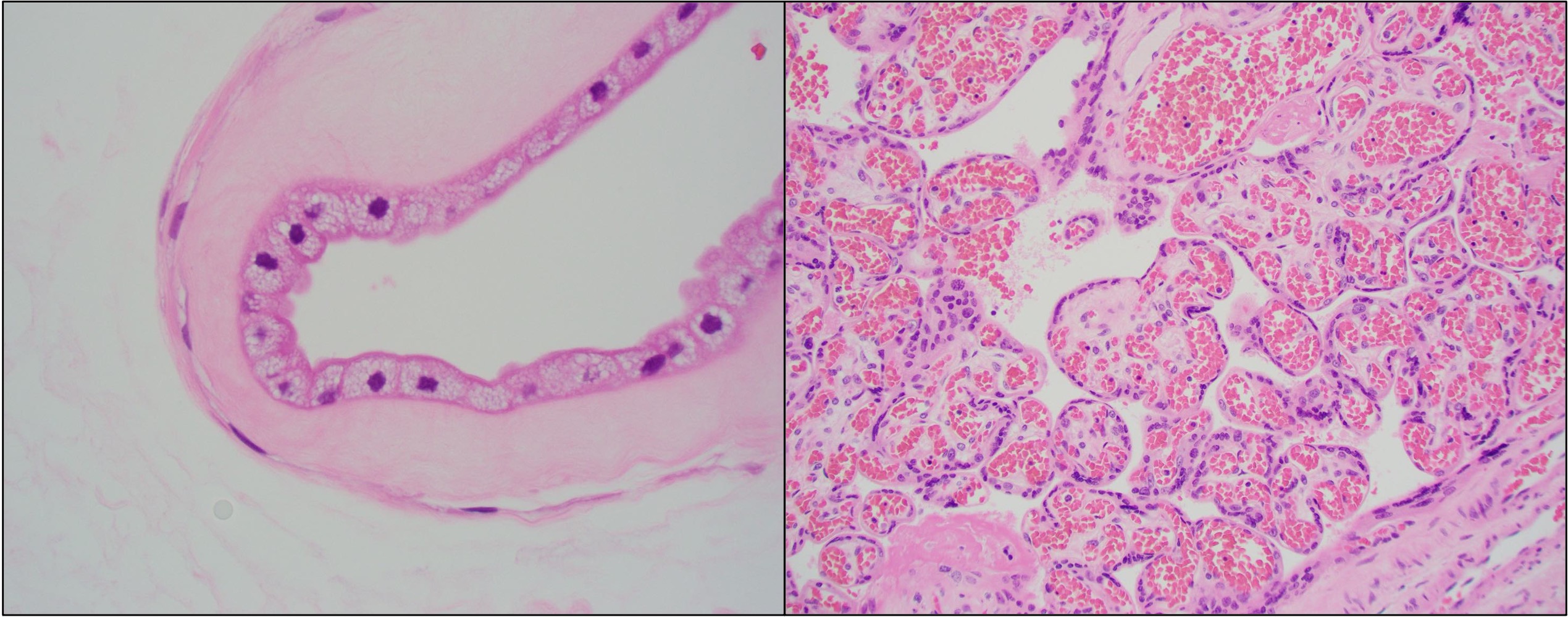 Exploring Pediatric Pathology – Helping Pathologists Help Kids